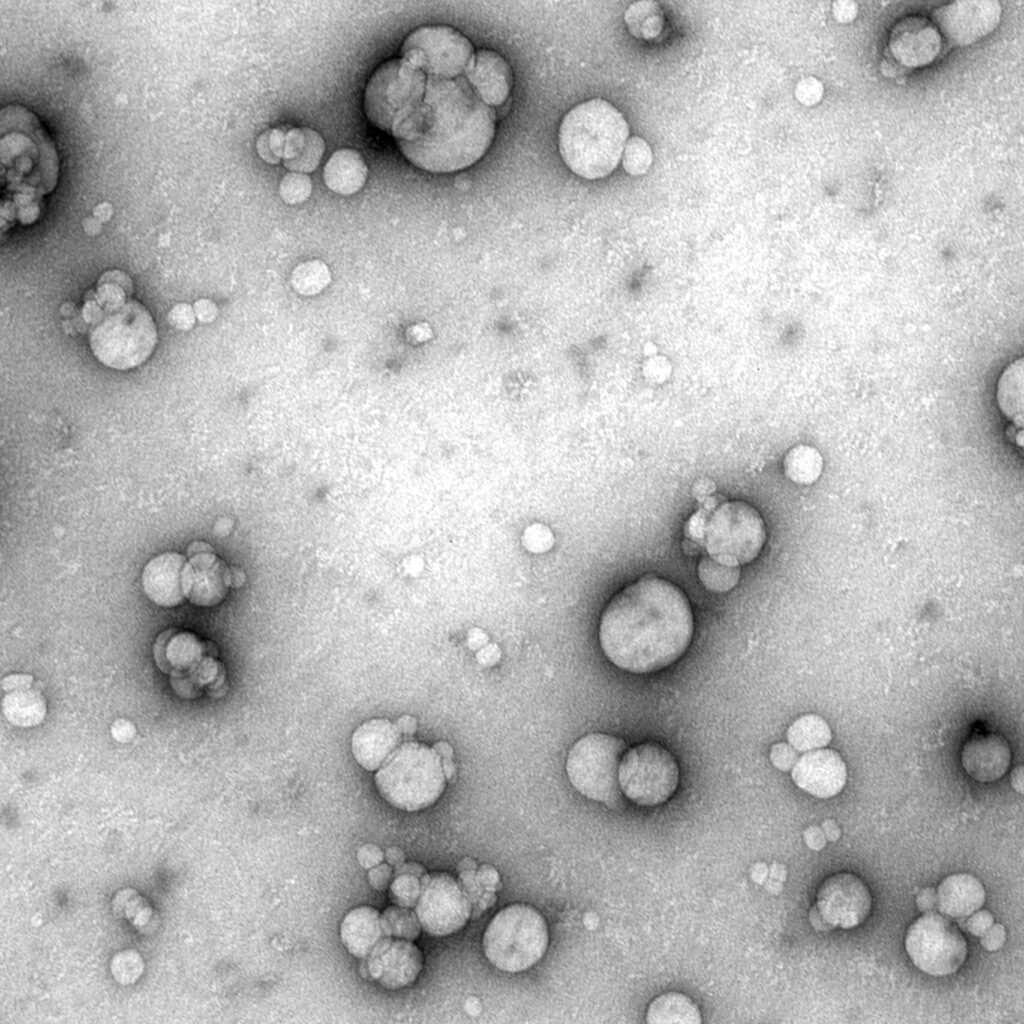 BioExoTec – The Future of Cancer Diagnostics – Small Particles, Big Impact